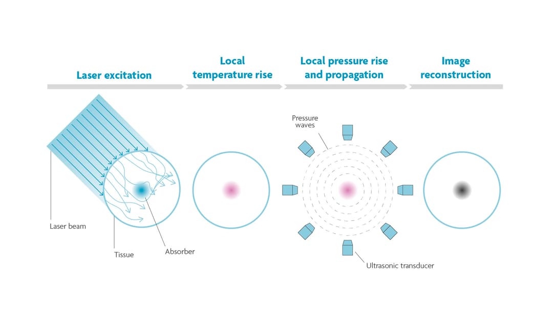 Photoacoustics for biomedical applications | imec