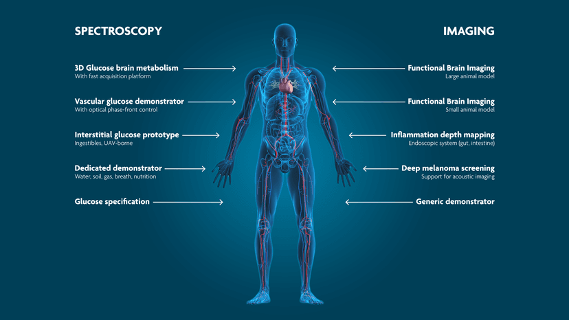 Photoacoustics for biomedical applications | imec