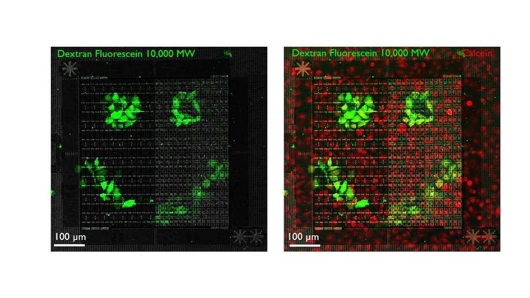 How chip technology will decipher brain diseases | imec