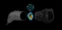 Hypervision Advances Surgical Intelligence with Next-Generation AI ...