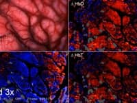 Hyperspectral imaging: on-chip, real-time and compact | imec