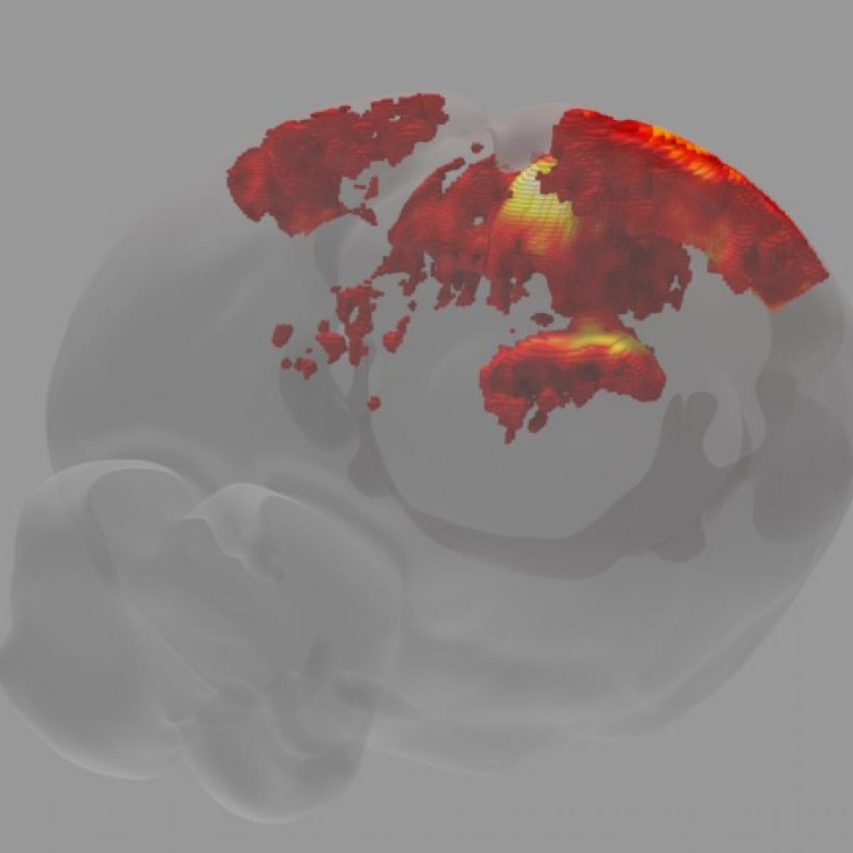 Ultrasound imaging to study the brain | imec